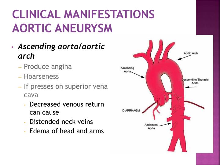 Ppt Aortic Aneurysm Powerpoint Presentation Id 2702581