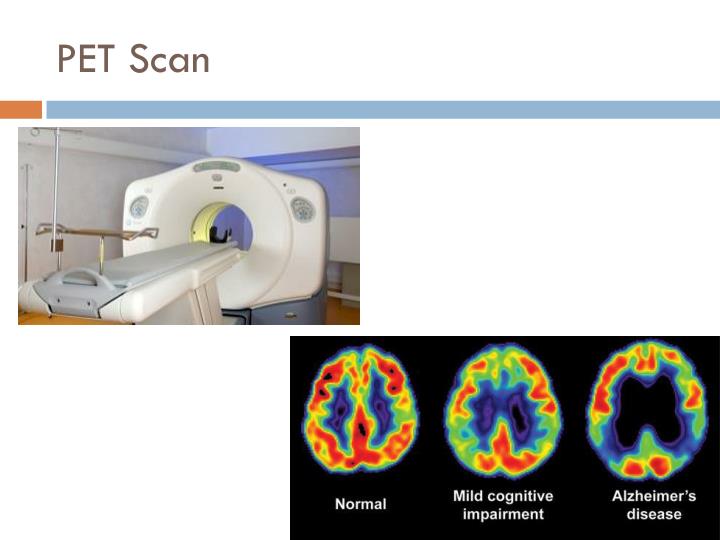 PPT - Unit 3: Biological Level of Analysis PowerPoint Presentation - ID ...