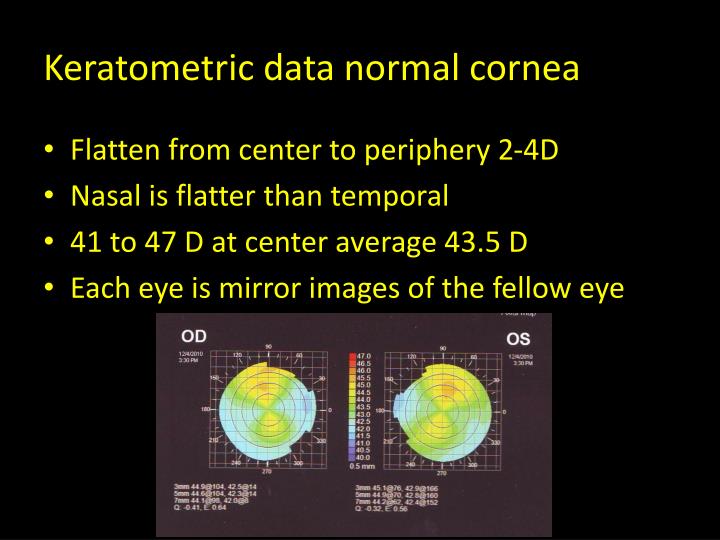 PPT - T opography in keratoconus PowerPoint Presentation - ID:2707380