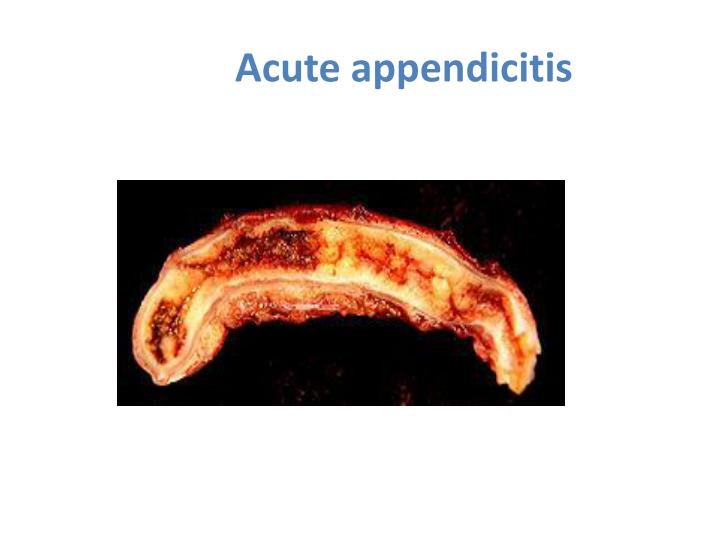 PPT - Inflammation and repair PowerPoint Presentation - ID:2708504