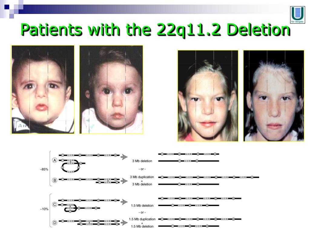 PPT - Genetica delle cardiopatie congenite PowerPoint Presentation ...