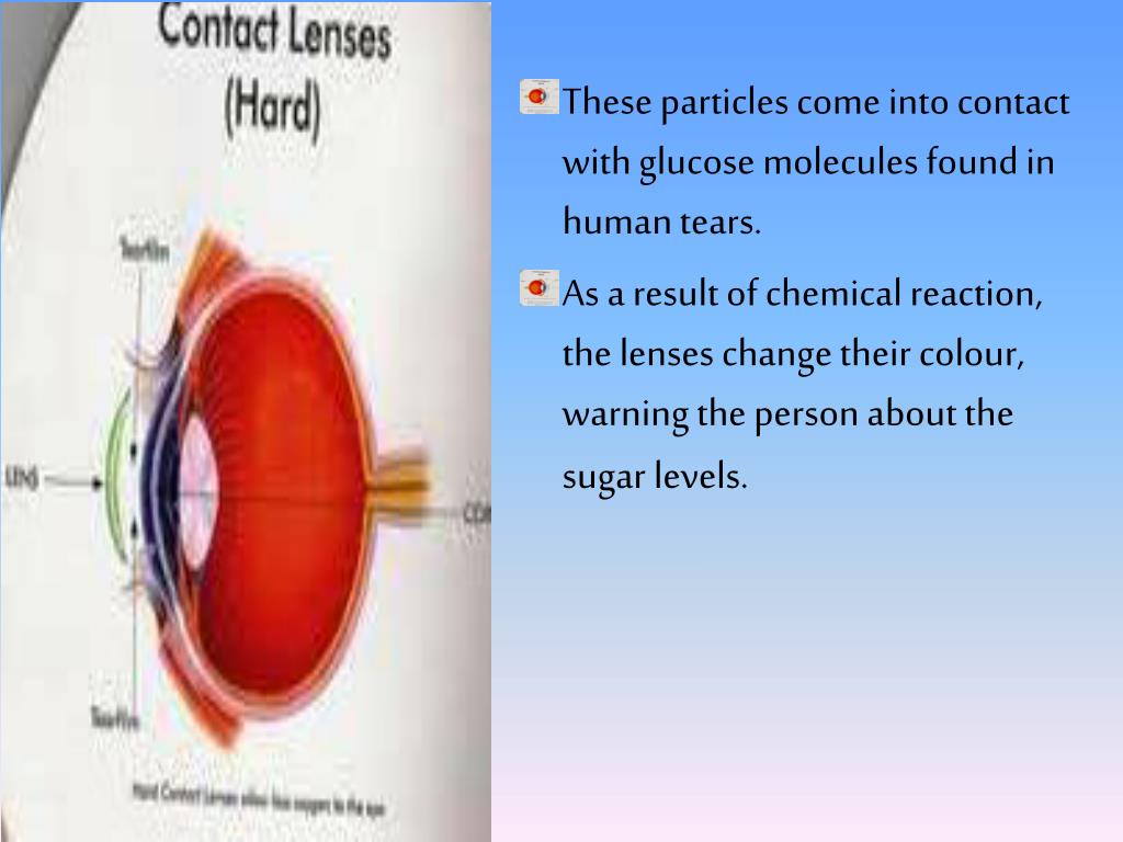 PPT - CONTACT LENS THAT INFORMS ABOUT THE BLOOD GLUCOSE LEVELS ...