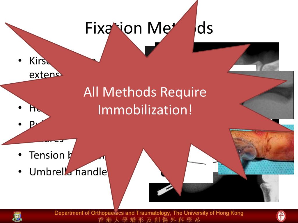 PPT - Jason Pui Yin Cheung , Boris Fung, Wing Yuk Ip Department of ...