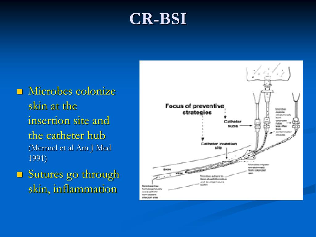 PPT - Prevention of Catheter-Related Infections in the Adult and ...