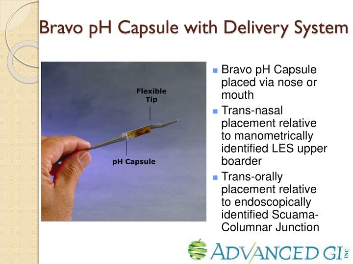 PPT - Endoscopic Diagnosis of Hiatal Hernia PowerPoint Presentation ...