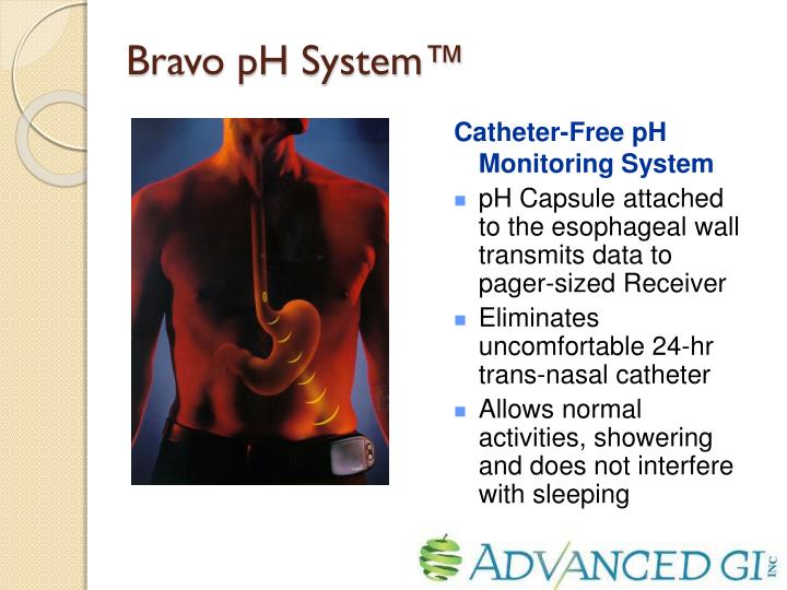PPT - Endoscopic Diagnosis of Hiatal Hernia PowerPoint Presentation ...