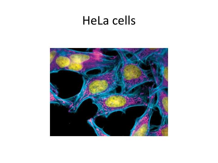 PPT - Henrietta Lacks PowerPoint Presentation - ID:2717845