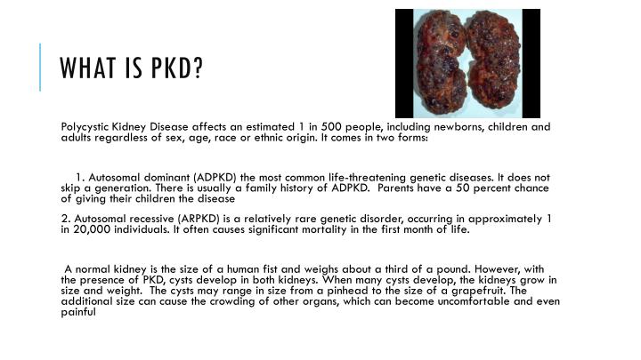 PPT - Polycystic Kidney Disease (PKD) PowerPoint Presentation - ID:2721580