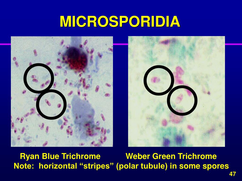 PPT - 2013 PARASITOLOGY WORKSHOP Lynnegarcia2@verizon PowerPoint ...