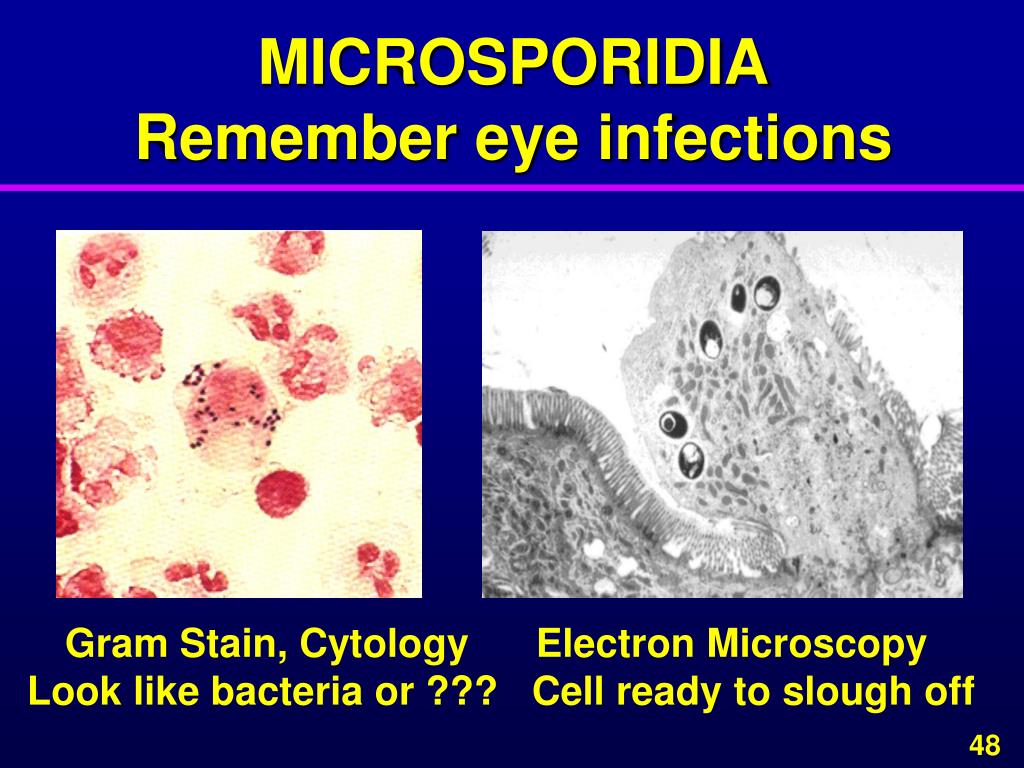 PPT - 2013 PARASITOLOGY WORKSHOP Lynnegarcia2@verizon PowerPoint ...