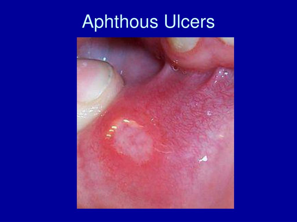 PPT - Clinical Aspects of HIV Disease PowerPoint Presentation, free ...