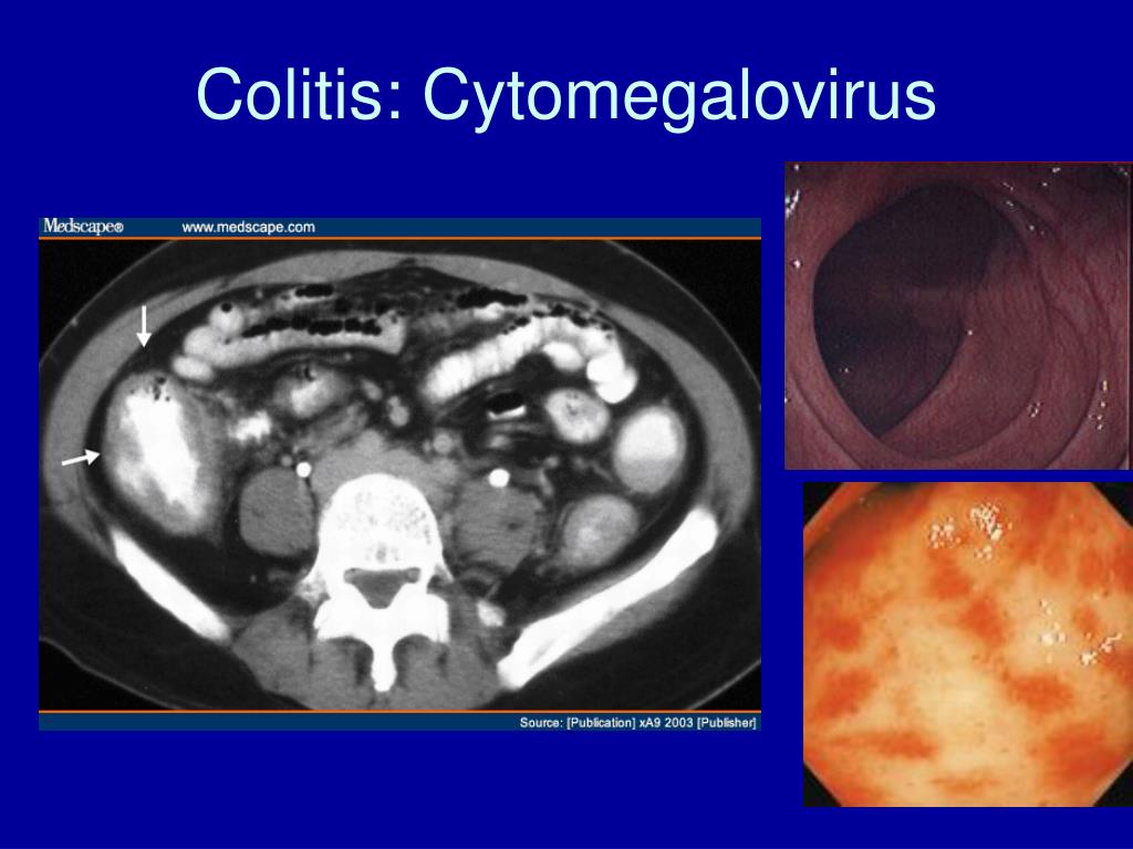 PPT - Clinical Aspects of HIV Disease PowerPoint Presentation, free ...