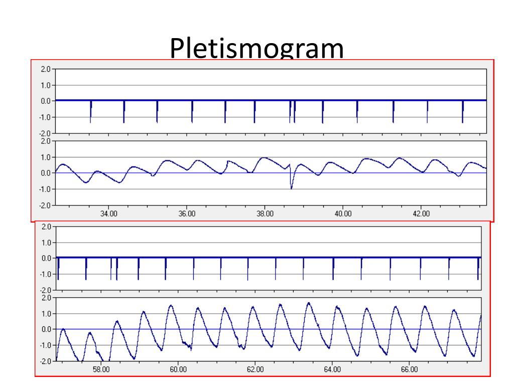 PPT - Az ayurveda diagnosztikája PowerPoint Presentation, free download ...