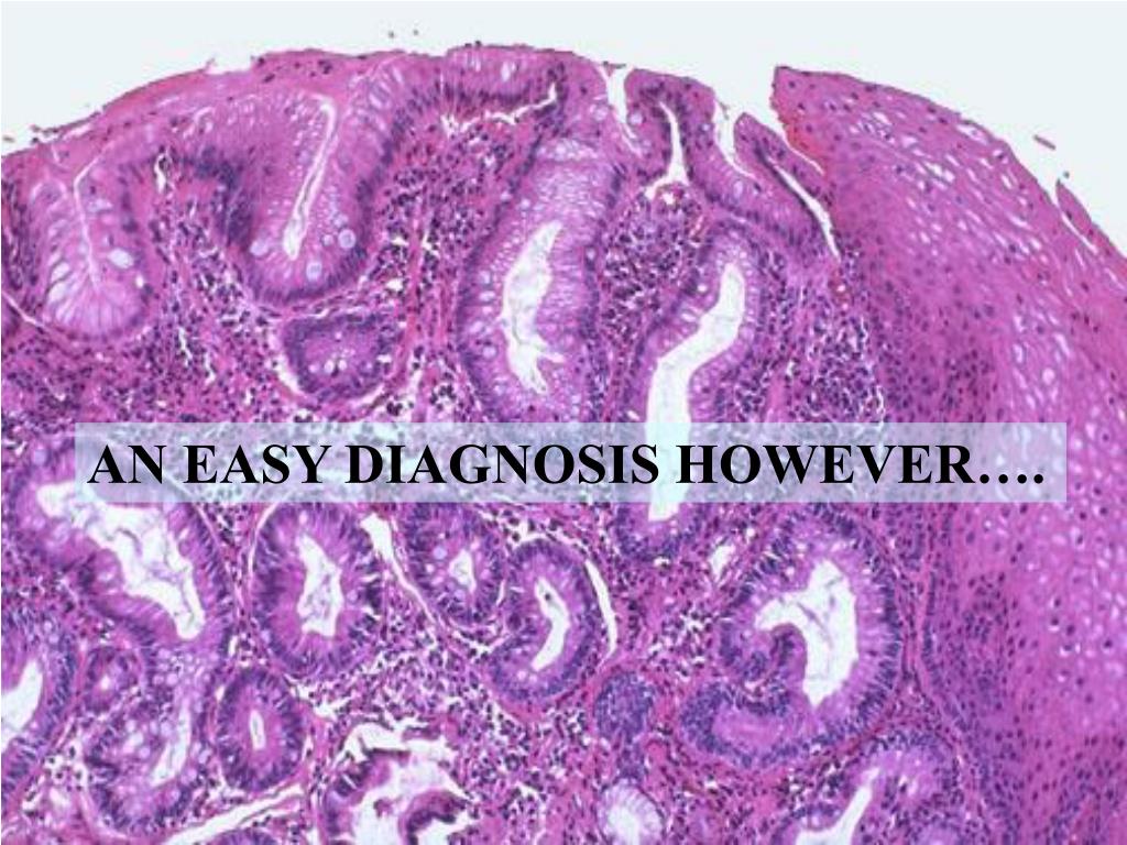 PPT - Roberto Fiocca Anatomia Patologica Università di Genova ...