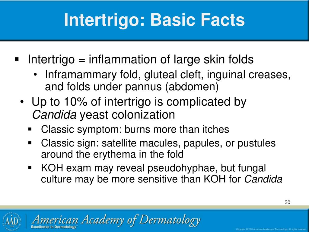 PPT - Adult Cutaneous Fungal Infections 2: Yeasts PowerPoint ...