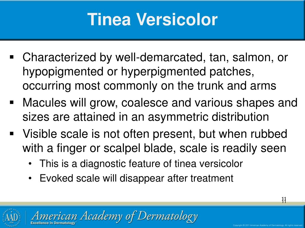 PPT - Adult Cutaneous Fungal Infections 2: Yeasts PowerPoint ...