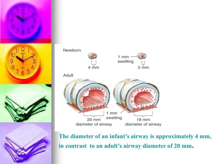 PPT - Pediatric Respiratory Disorders PowerPoint Presentation - ID:2733908