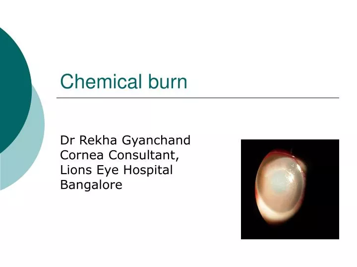 PPT - Chemical burn PowerPoint Presentation, free download - ID:2736547