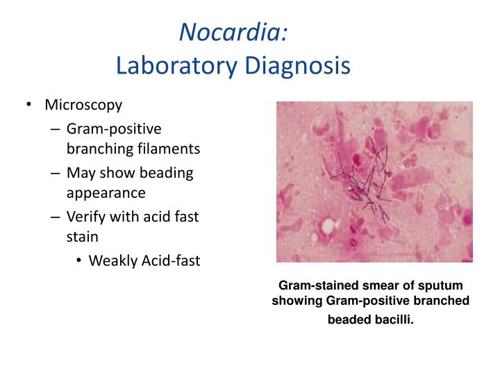 PPT - Gram-Positive Bacilli Part Four PowerPoint Presentation - ID:2738656