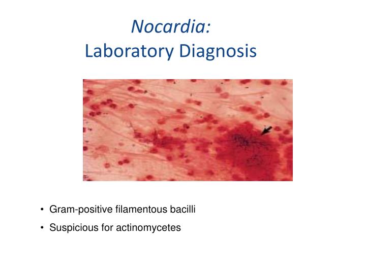 PPT - Gram-Positive Bacilli Part Four PowerPoint Presentation - ID:2738656