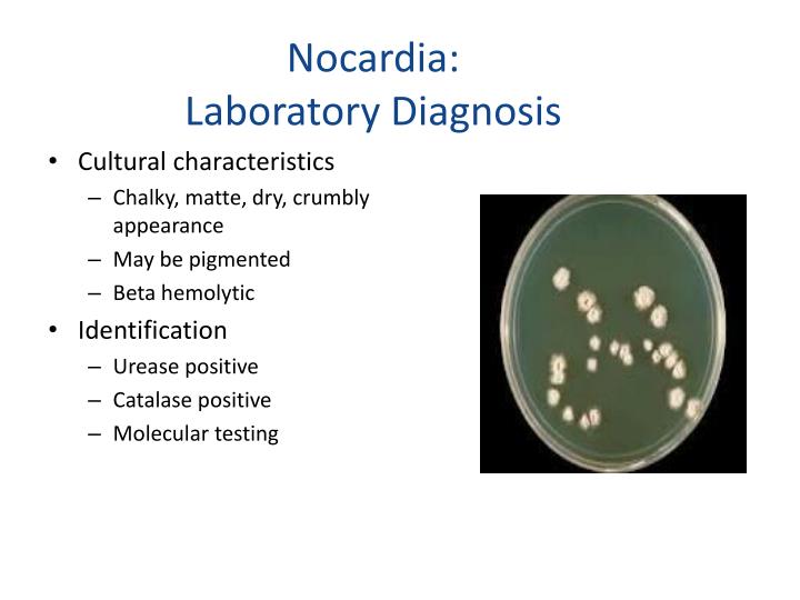 PPT - Gram-Positive Bacilli Part Four PowerPoint Presentation - ID:2738656