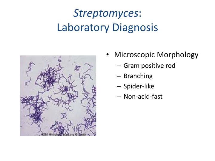PPT - Gram-Positive Bacilli Part Four PowerPoint Presentation - ID:2738656