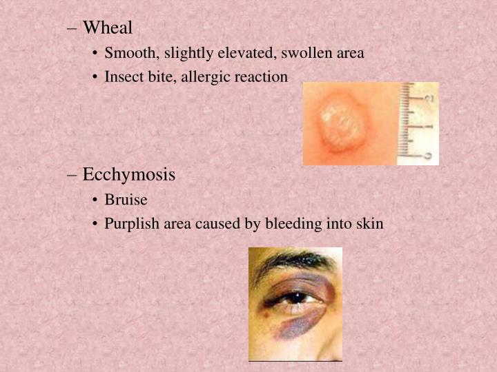 PPT - The Integumentary System PowerPoint Presentation - ID:2739673