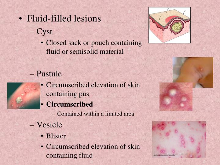 PPT - The Integumentary System PowerPoint Presentation - ID:2739673