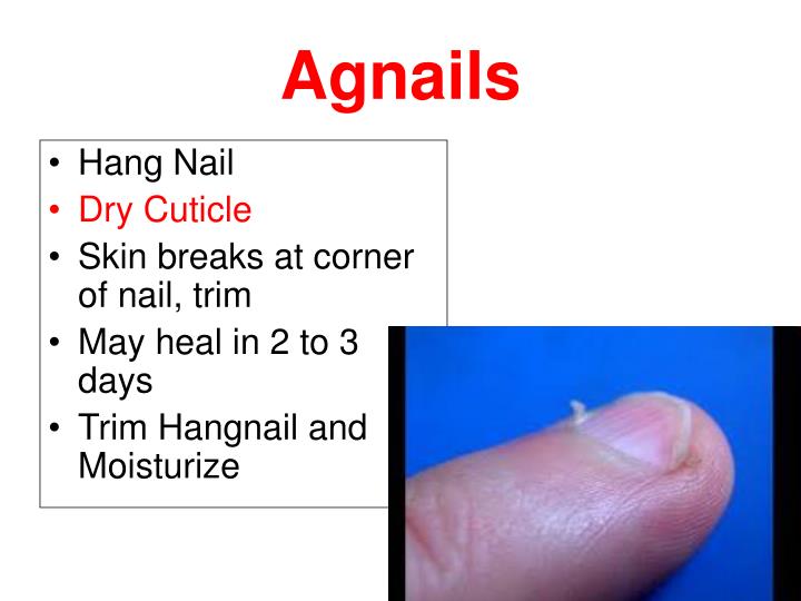 PPT - Nail Theory PowerPoint Presentation - ID:2742453