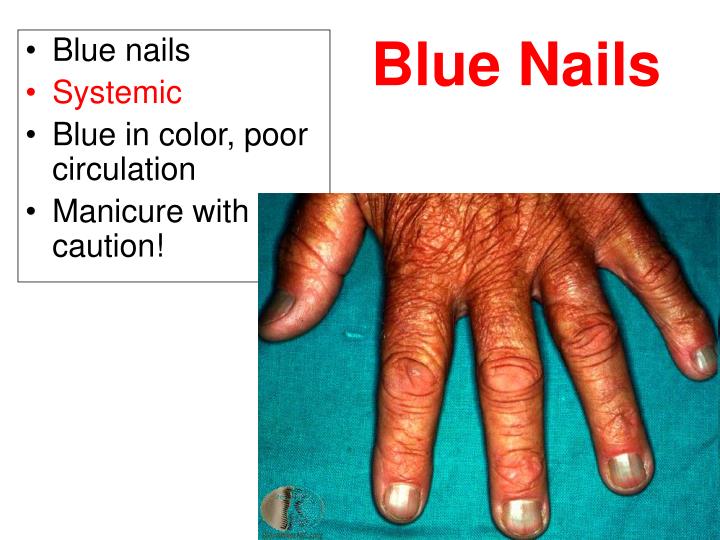 PPT - Nail Theory PowerPoint Presentation - ID:2742453