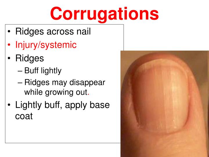 PPT - Nail Theory PowerPoint Presentation - ID:2742453
