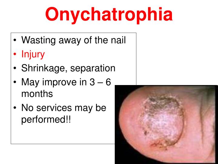 PPT - Nail Theory PowerPoint Presentation - ID:2742453