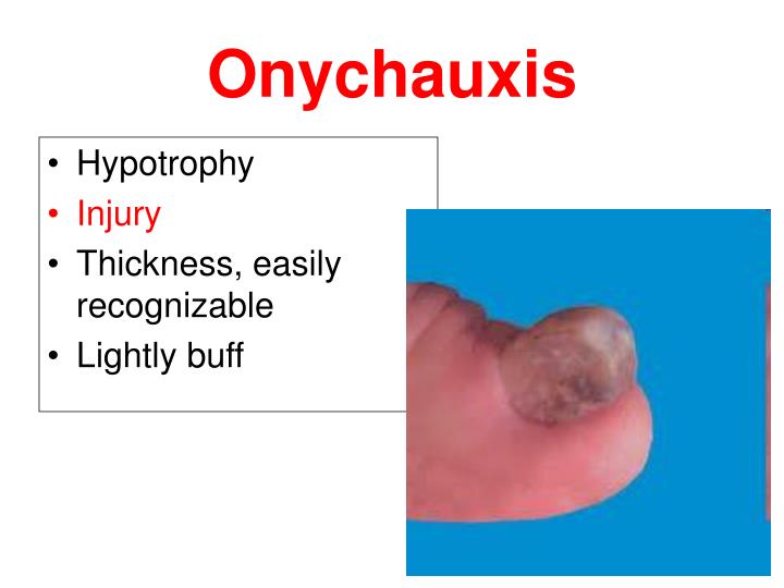 PPT - Nail Theory PowerPoint Presentation - ID:2742453