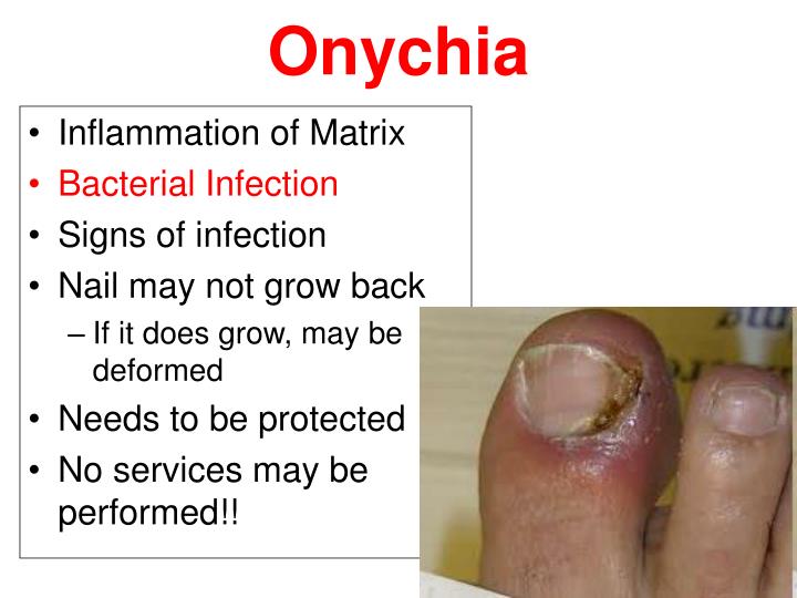 PPT - Nail Theory PowerPoint Presentation - ID:2742453