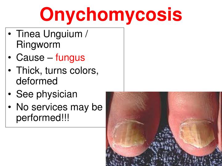 PPT - Nail Theory PowerPoint Presentation - ID:2742453