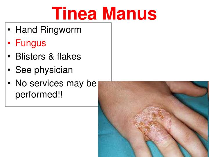 PPT - Nail Theory PowerPoint Presentation - ID:2742453