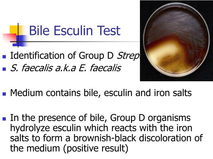 PPT - Streptococcus PowerPoint Presentation - ID:2742719