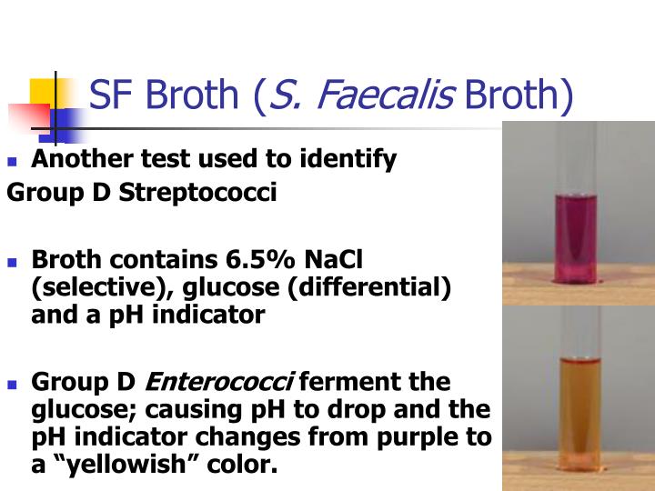 PPT - Streptococcus PowerPoint Presentation - ID:2742719