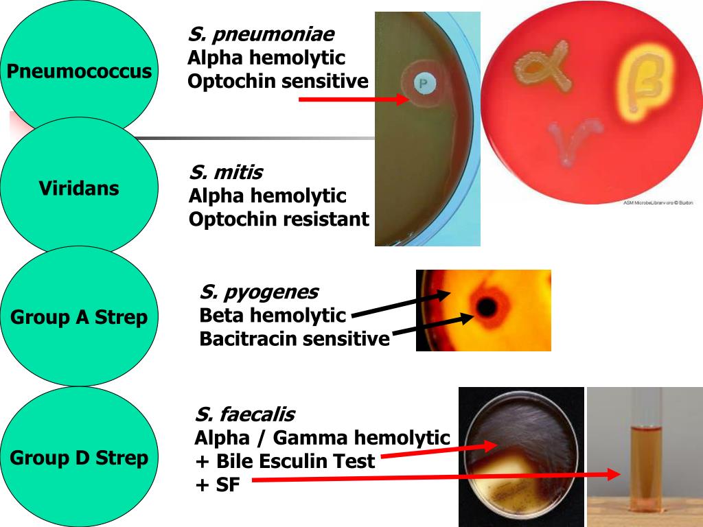 PPT - Streptococcus PowerPoint Presentation, free download - ID:2742719 PPT - Streptococcus PowerPoint Presentation, free download - ID:2742719