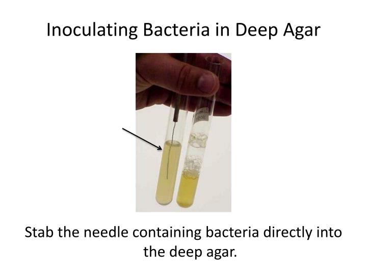 PPT - Lab 1: Aseptic Technique and Isolation of Bacteria PowerPoint ...