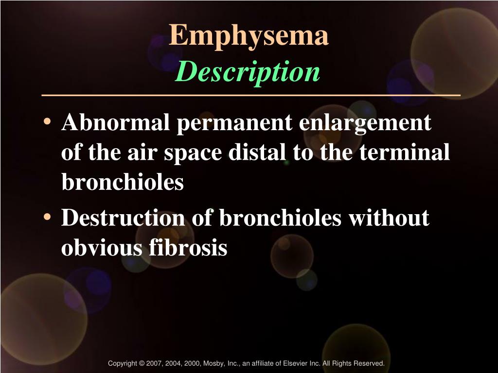 PPT - Focus on Chronic Obstructive Pulmonary Disease (COPD) PowerPoint ...