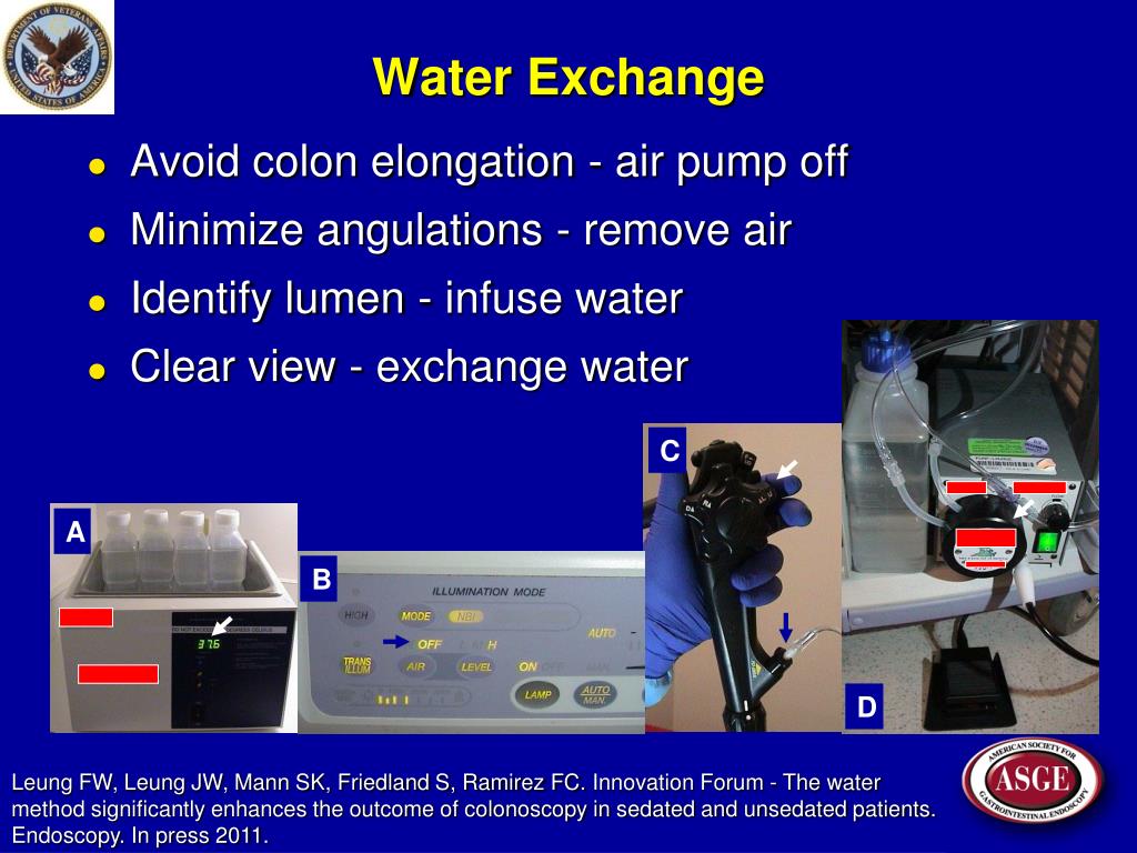 PPT - Water-aided Colonoscopy: water immersion & water exchange ...