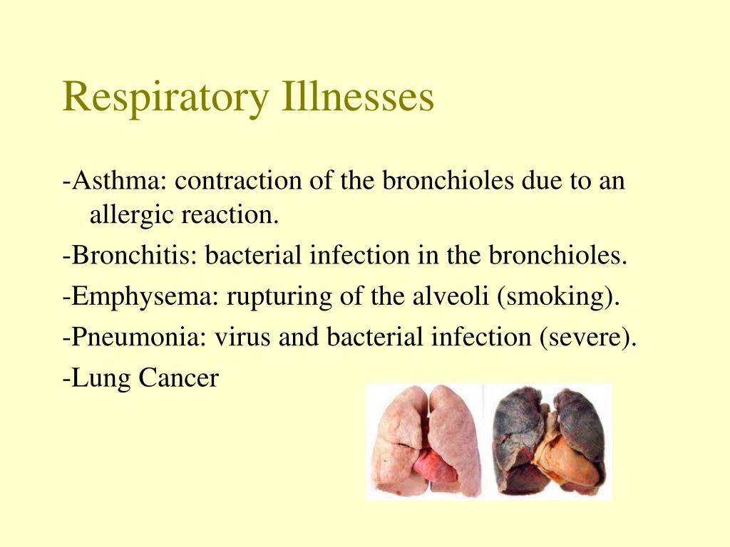 PPT - The Respiratory System PowerPoint Presentation, free download ...