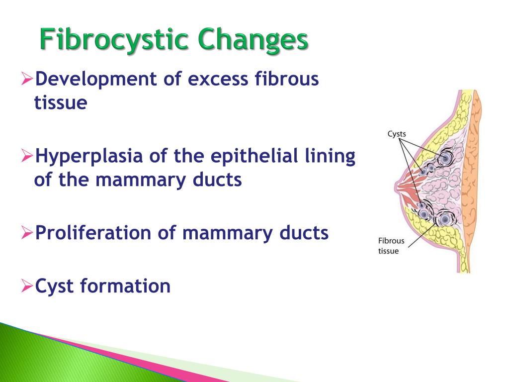 PPT - Nursing Care of the Woman with a Disorder of the Breast ...
