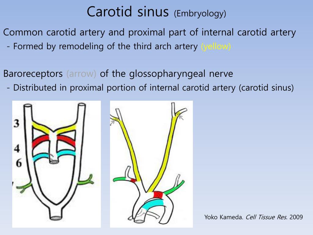 PPT - Sinus reaction during carotid stenting according to the carotid ...