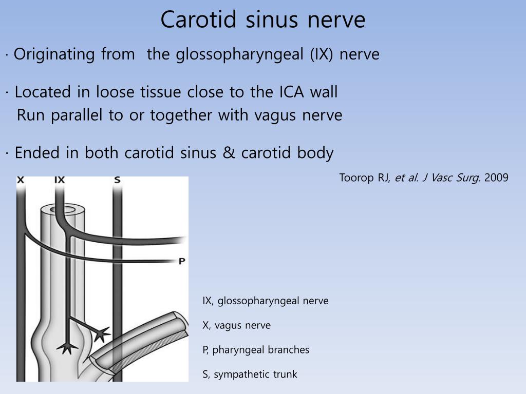 PPT - Sinus reaction during carotid stenting according to the carotid ...