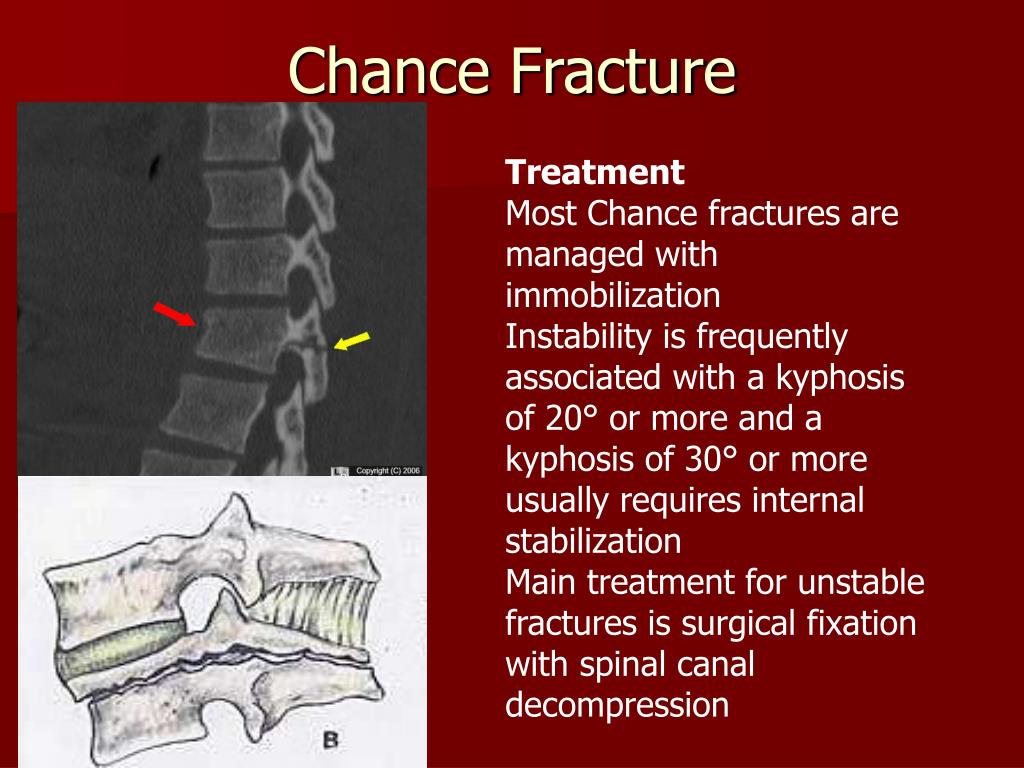 PPT - Follow up CT scan on 20 year old male with back pain PowerPoint ...