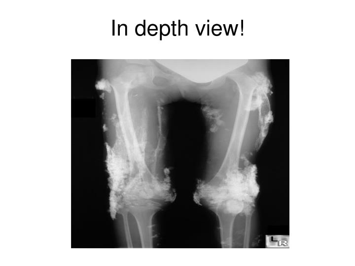 PPT - Myositis Ossificans Traumatica PowerPoint Presentation - ID:2749519
