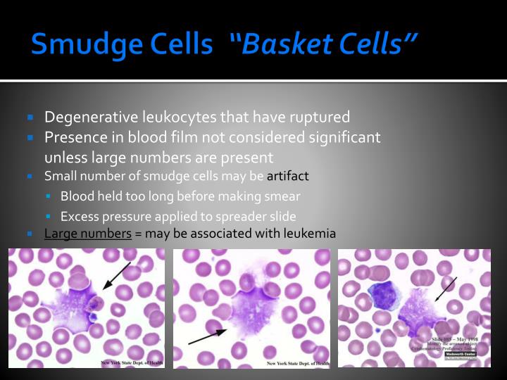 PPT - Leukocytes WBC Morphology Clinical Pathology VTHT 2323 Lori ...