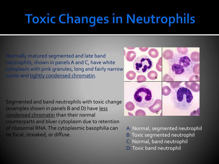 PPT - Leukocytes WBC Morphology Clinical Pathology VTHT 2323 Lori ...